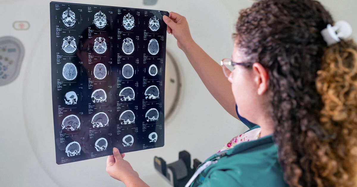 Tonic-Clonic Seizure: Symptoms, What to Do, and More