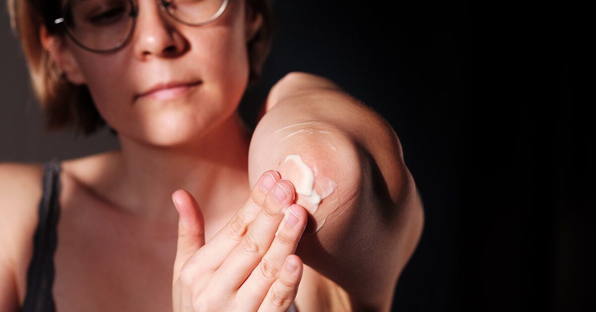 Early Stages and Symptoms of Psoriasis by Type