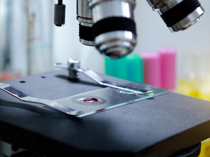 Types of Myelodysplastic Syndromes