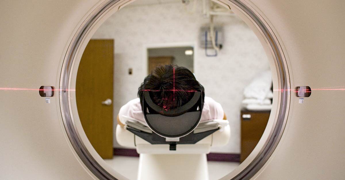 Subdural Hematoma: Symptoms, Diagnosis, and Treatments