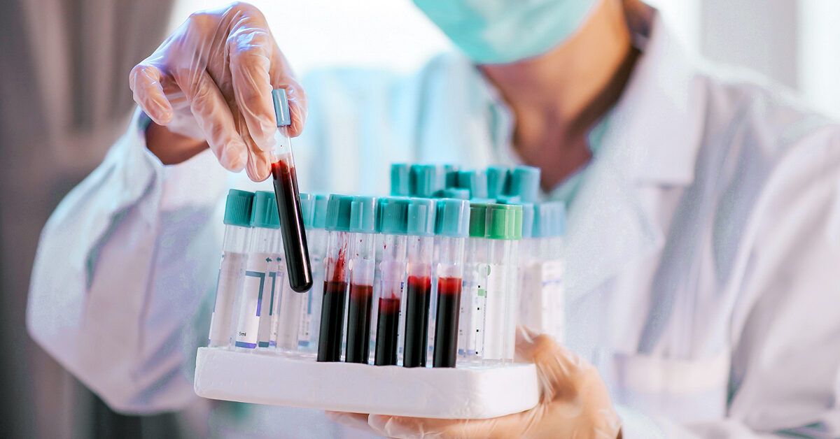 Ovarian Cancer Tumor Marker Tests: Types & Uses