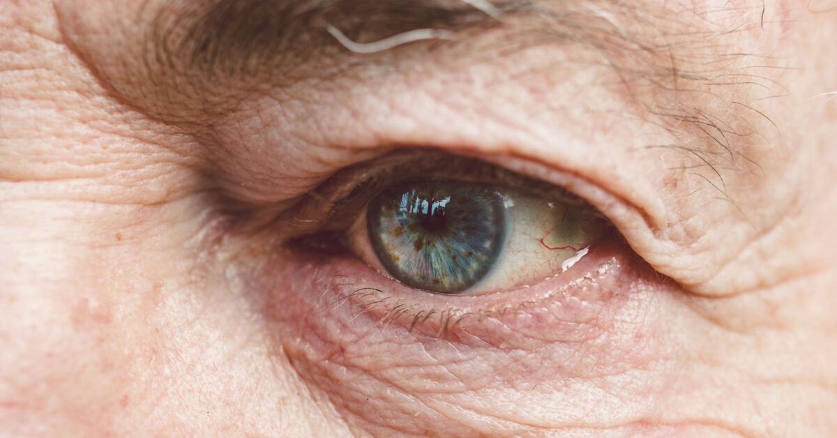 Your Eyes as You Get Older: What to Know