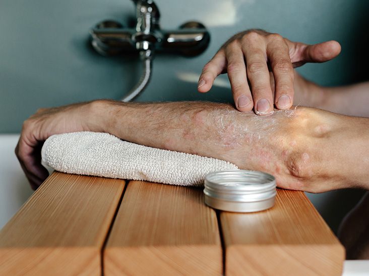 Shingles vs Eczema: Skin Rash and Symptom Differences