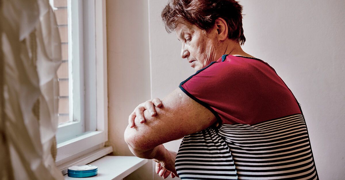 Hives and Parkinson's Disease: Itching, Sweating, Skin Problems