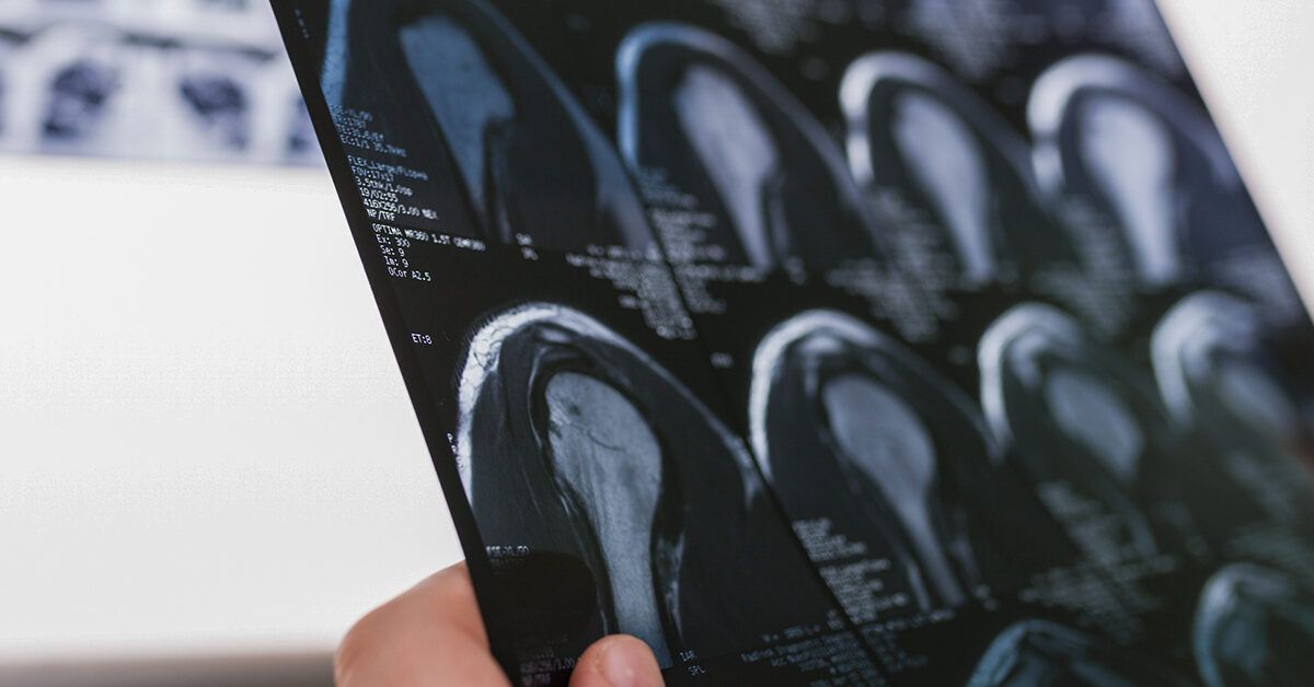 What Is An Arthrogram?