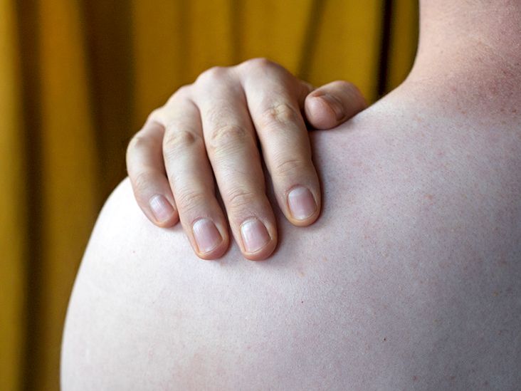 Chronic Lymphocytic Leukemia Skin Lesions: Causes and Types