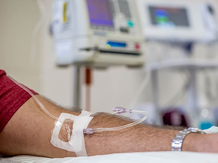 IVIG Treatment for Crohn’s Disease: Effectiveness, Precautions