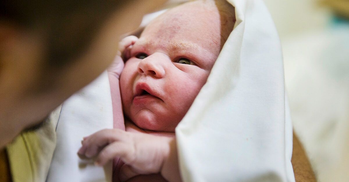 Hypospadias: What It Is, Diagnosis, Treatment, and More