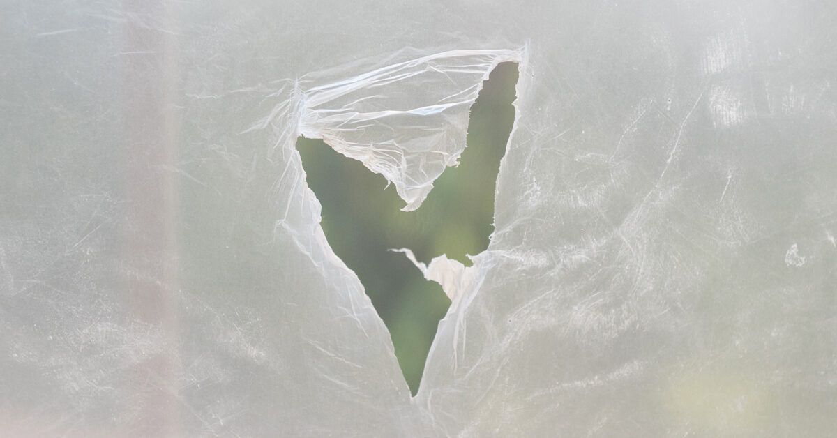 Coronary Artery Dissection (SCAD): Types, Symptoms, Treatment