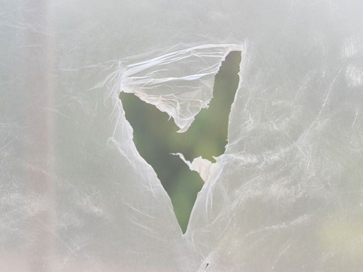 Coronary Artery Dissection (SCAD): Types, Symptoms, Treatment