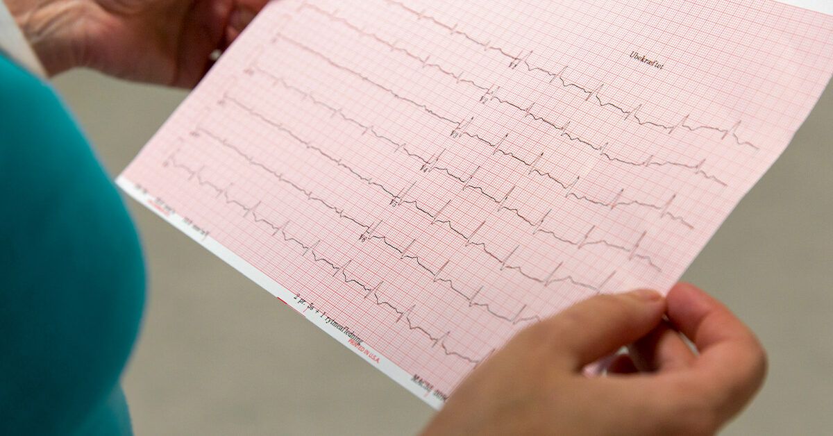 Asystole: Definition, Causes, Treatment, Outlook
