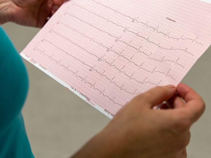 Asystole: Definition, Causes, Treatment, Outlook