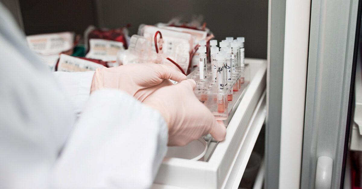 Blood-based Biomarker Tests for Colorectal Cancer Screening