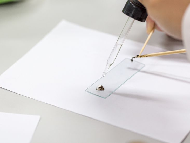 Gastroenteritis and Stool Culture: Why It's Needed and How It Helps