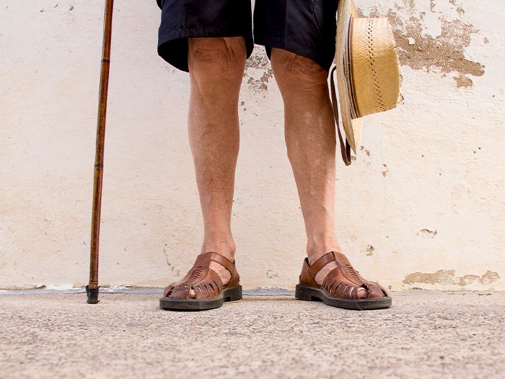 Post-Polio Syndrome: Symptoms, Treatment, and Outlook