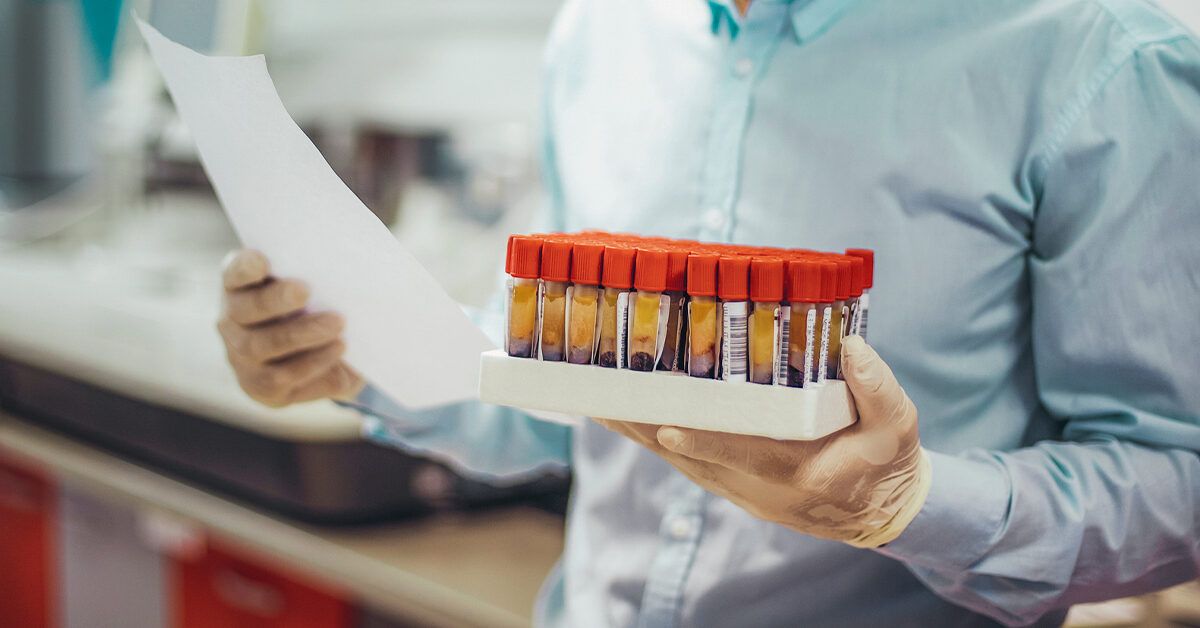 What To Do About Fluctuating Liver Enzyme Levels