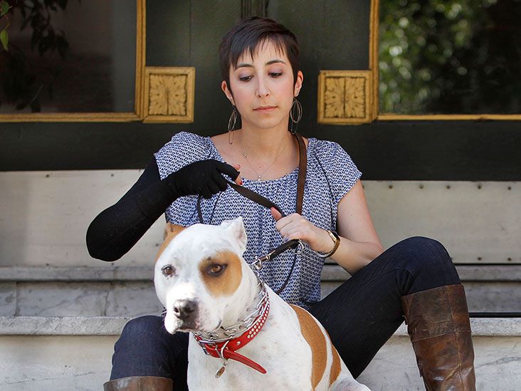 Compression Sleeves for Lymphedema: 8 FAQs