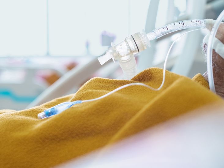 Extubation after Being on a Ventilator: Procedure, Timing, Risks