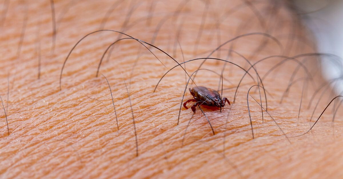 What Is Anaplasmosis? Know the Signs and How to Prevent It