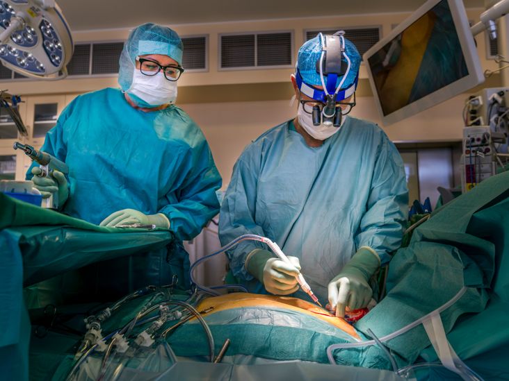 Annuloplasty for Heart Valve Repair: Procedure and Recovery