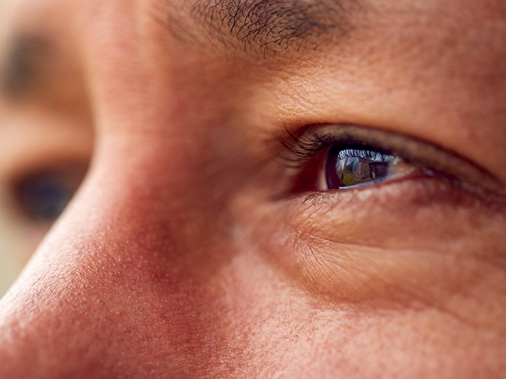 Blepharitis and Vitamin Deficiency: Is There a Link?