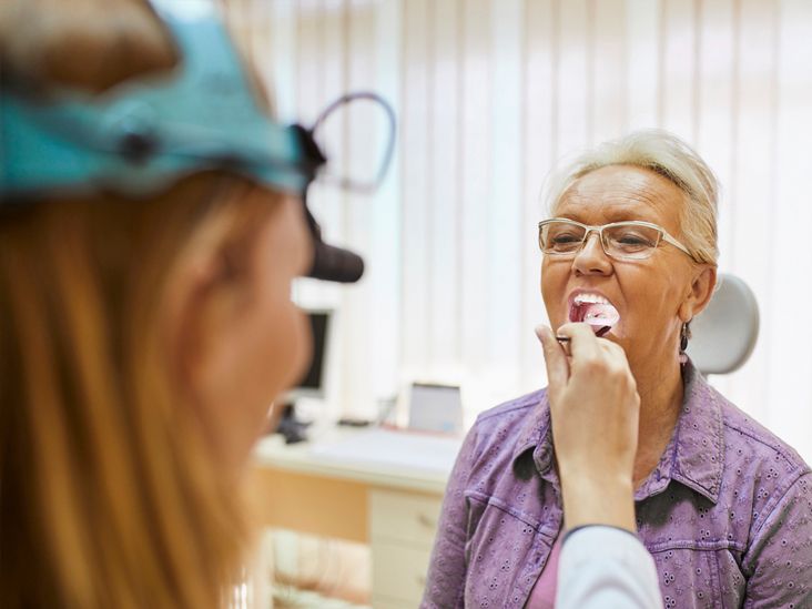 Oral Psoriasis: Symptoms, Pictures, Causes, and Treatment