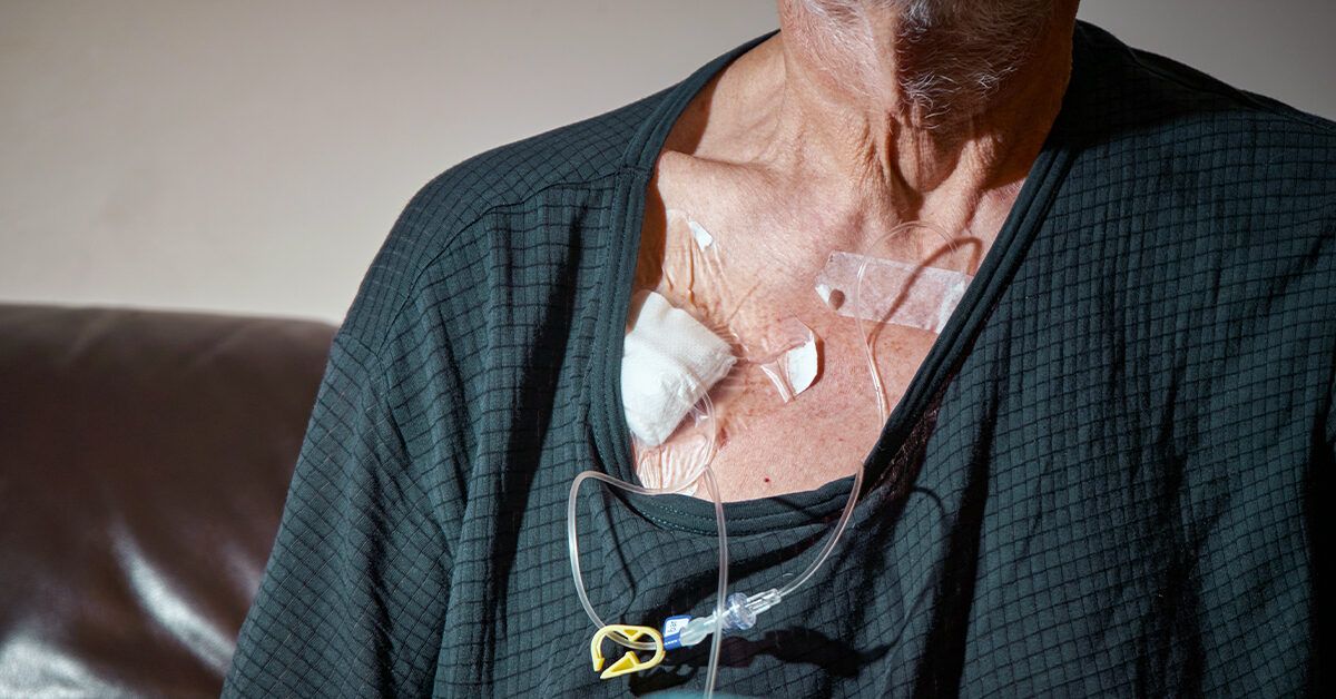 Chemotherapy Extravasation: Symptoms, Causes, Prevention, Treatment