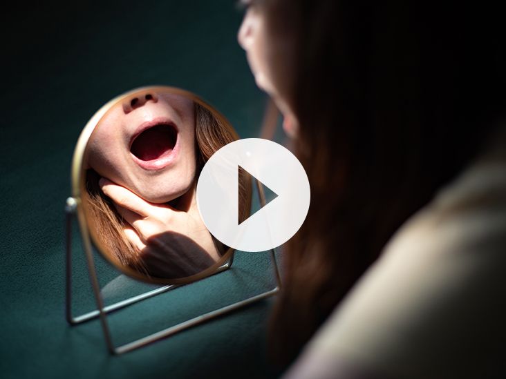 How to get rid of Tonsilloliths (tonsil stones)