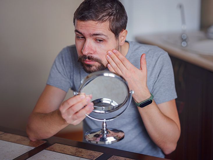 Pustular Psoriasis on Face: Symptoms, Diagnosis, Treatment