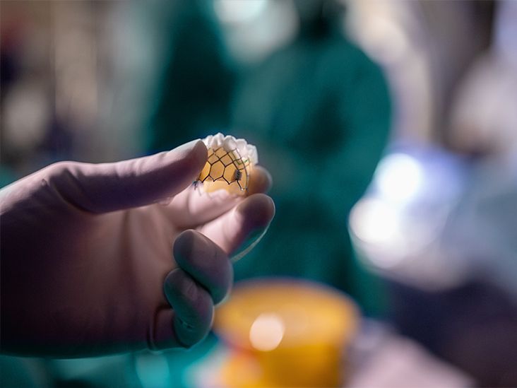 TAVR Procedure: Benefits, Risks, Recovery, Effectiveness