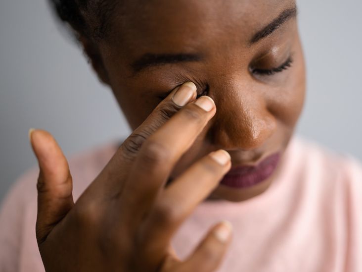 How to Cure Blepharitis Fast: What Works and When to Get Help