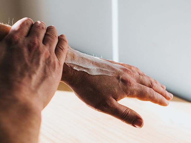 Psoriasis on Hands: Pictures, Management, and Prevention