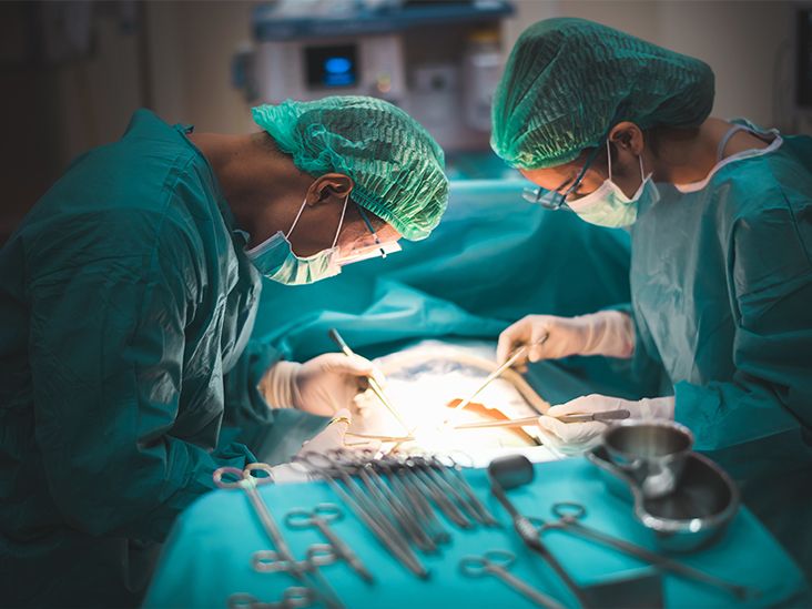 Duodenal Switch Surgery: What It Is, Why It’s Done, Procedure