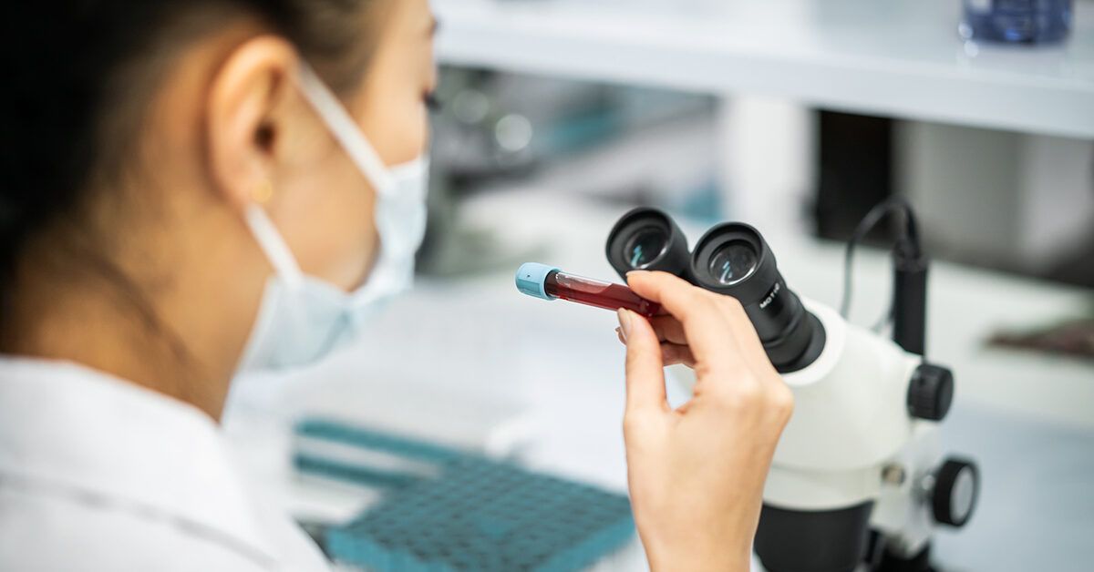 Is There a Test for Shingles?