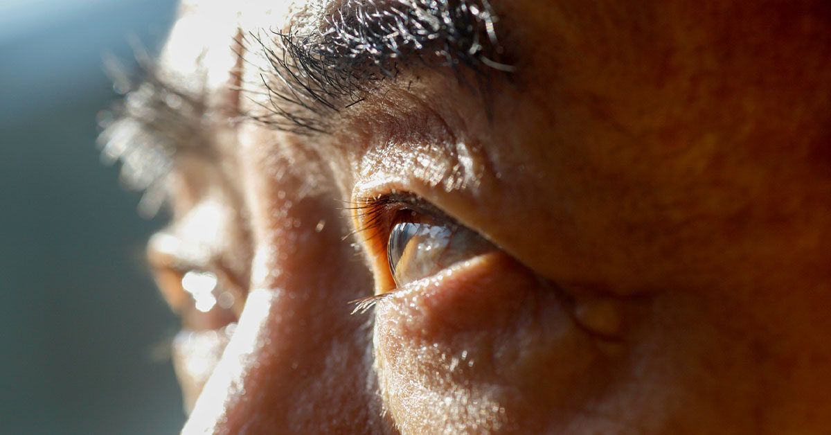 What Is the Usual Age of Onset for Macular Degeneration?