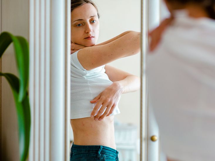 Shingles: Itchy Symptoms, Causes, Duration, and Treatment