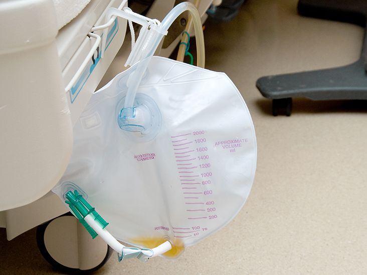 Urinary Wicking Devices: Types, Uses, and Benefits