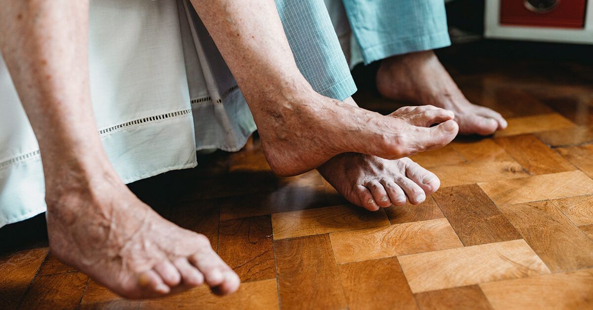 Lymphoma in the Leg: Symptoms, Treatment, and More