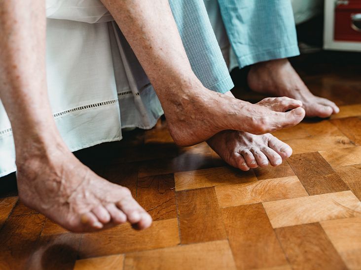 Lymphoma in the Leg: Symptoms, Treatment, and More