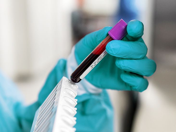 Galleri Cancer Test: Accuracy, Benefits, Risks, Cost