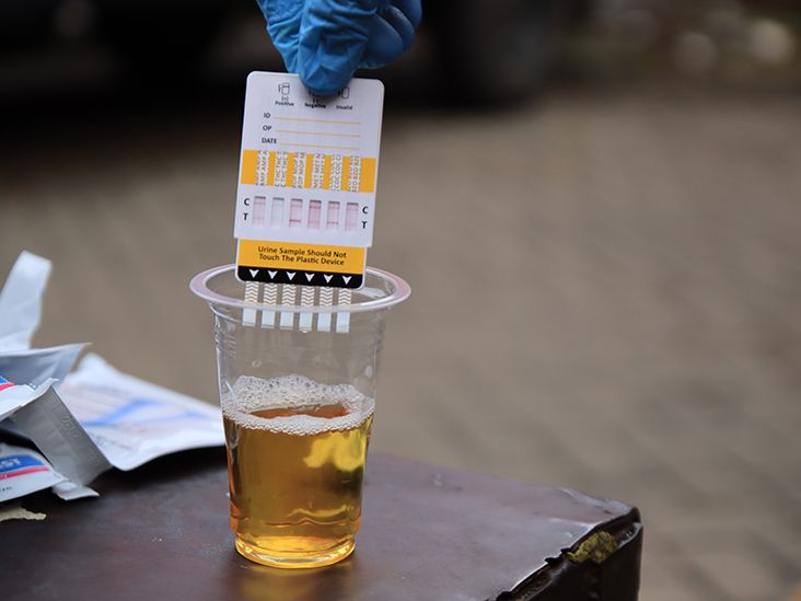 How Long Does Percocet Stay in Urine? Detection, Drug Test Cutoff