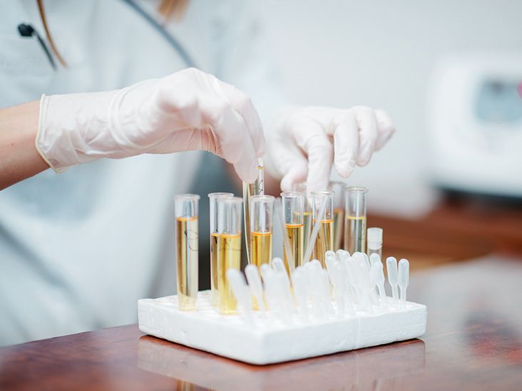 Hemoglobin in Urine: Causes, Diagnosis, Treatment