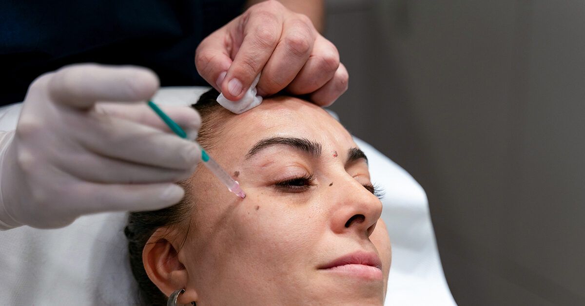 Can Botox Cause Dry Eyes? It’s Complicated