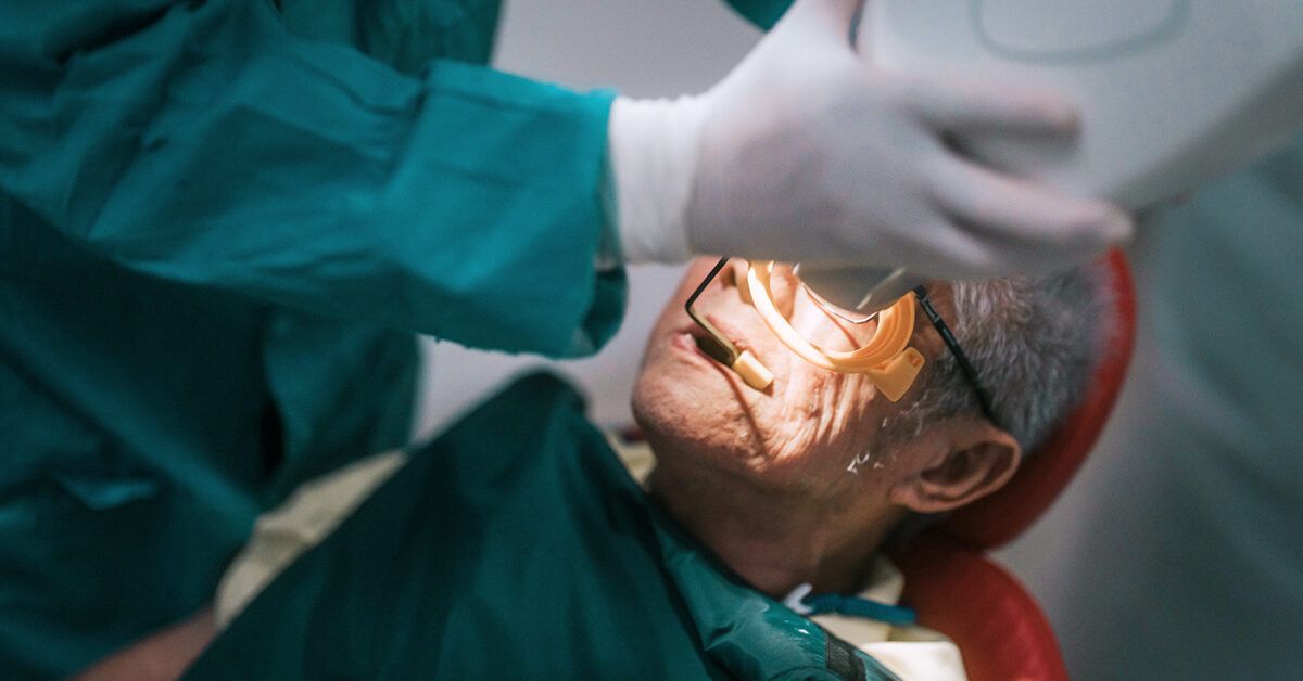 Oral Cavity Cancer: Symptoms, Picture, Risk Factors, Treatment, More