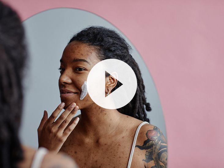 Acne Scars: At-Home and Clinical Treatment Options