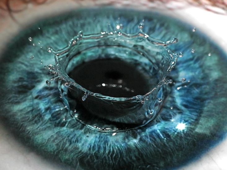 Microaneurysms in Your Eye from Diabetic Retinopathy