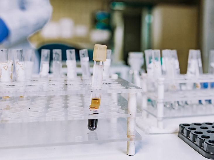 Monoclonal B-Cell Lymphocytosis: Causes, Treatment, Outlook