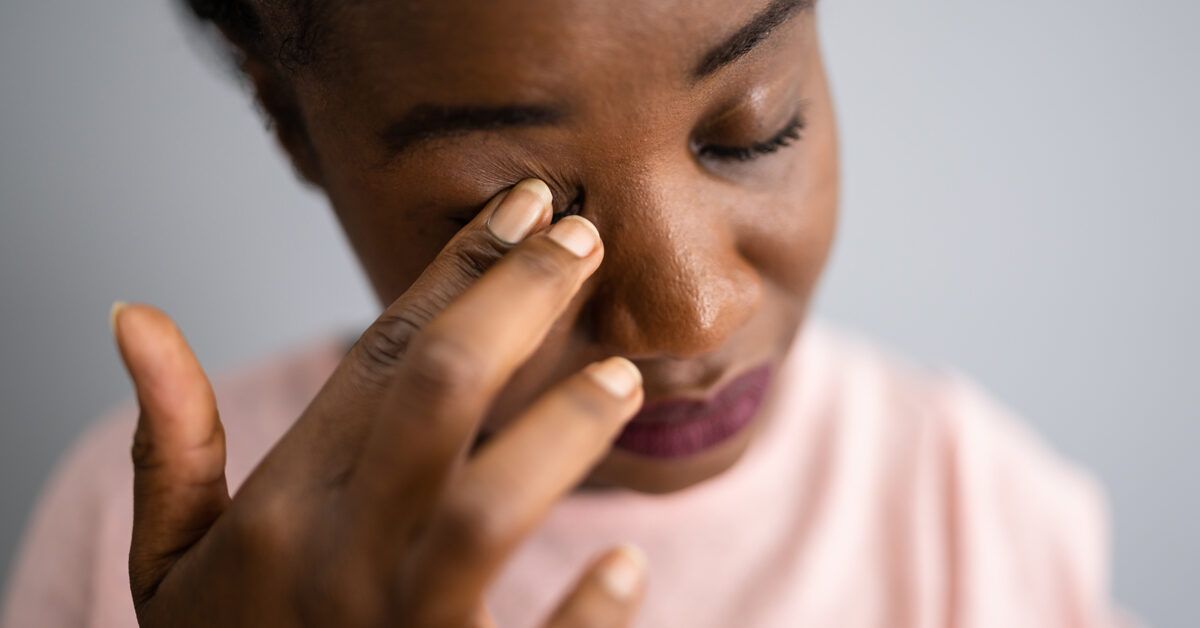 Ocular Tuberculosis: Symptoms, Causes, Treatment, and More