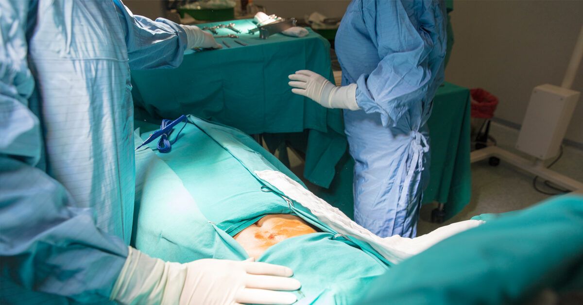 Ovarian Cancer Omentectomy: When Needed, What to Expect