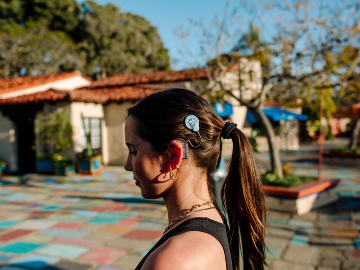 Your Guide To Rehab After Cochlear Implant